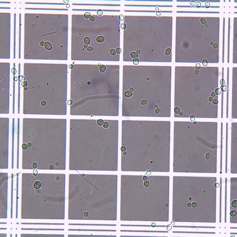 Yeast Cell Type Instance Segmentation Model By Aiml Cell Yeast Counter