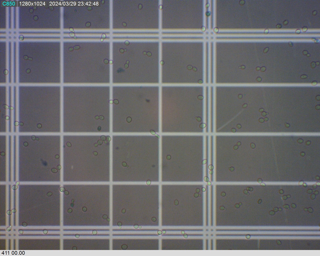 Infectioncell Object Detection Dataset And Pre Trained Model By Aiml