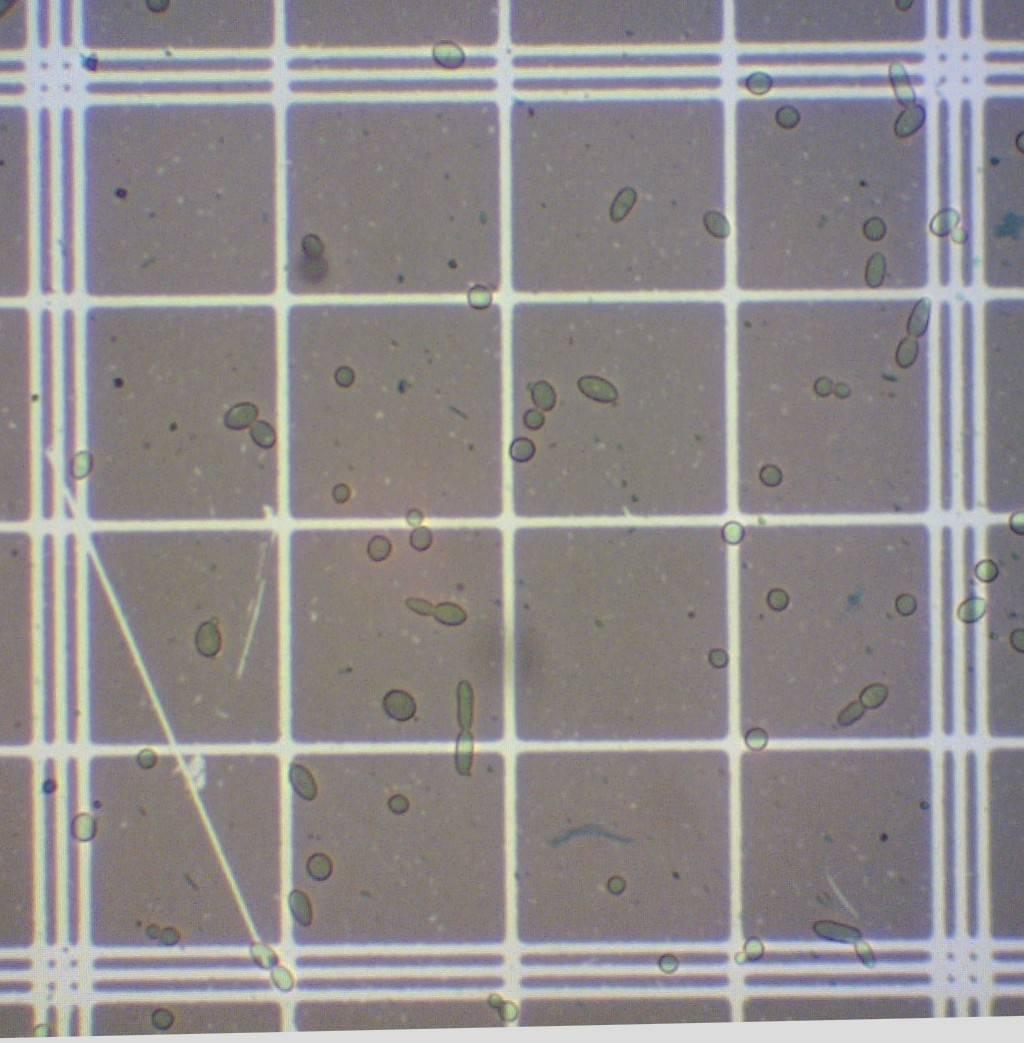Yeast Cell Counting V2 Object Detection Dataset And Pre Trained Model