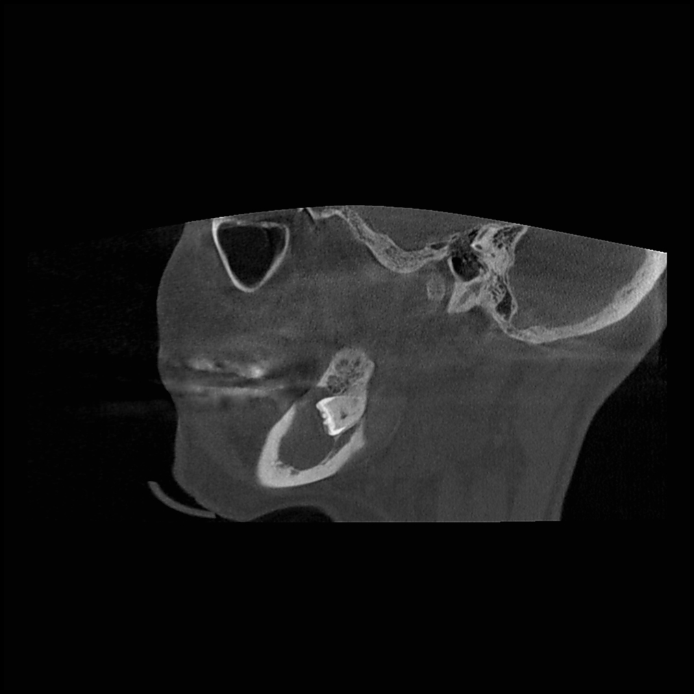 kist (kist-hqcxq) - Roboflow Universe