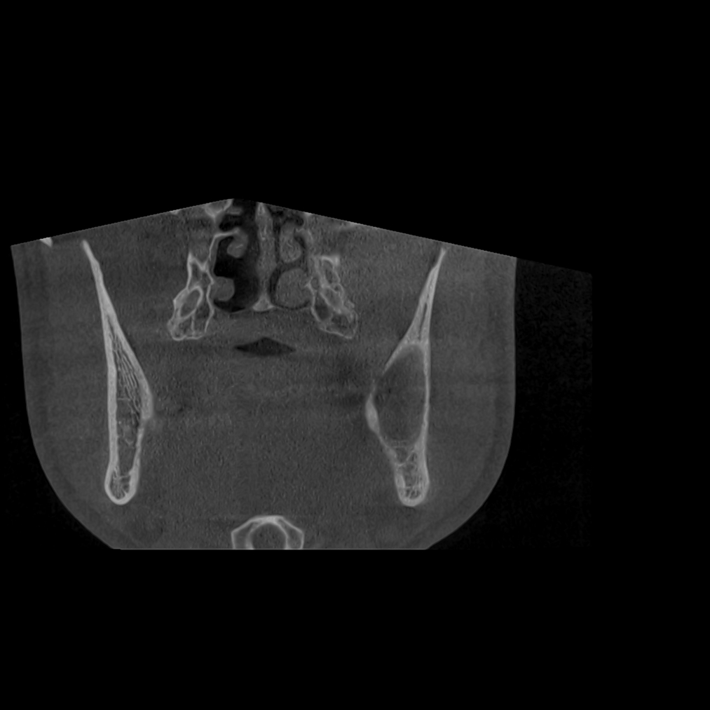 Kist-MandibularCanal Object Detection Dataset by kist