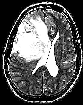 brain segment Instance Segmentation Model by education science
