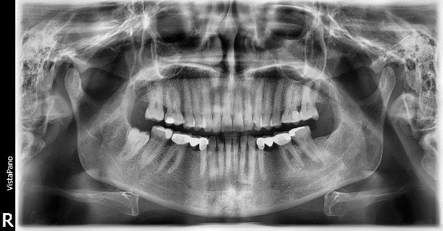 teeth_class_train Classification Dataset by Khalid