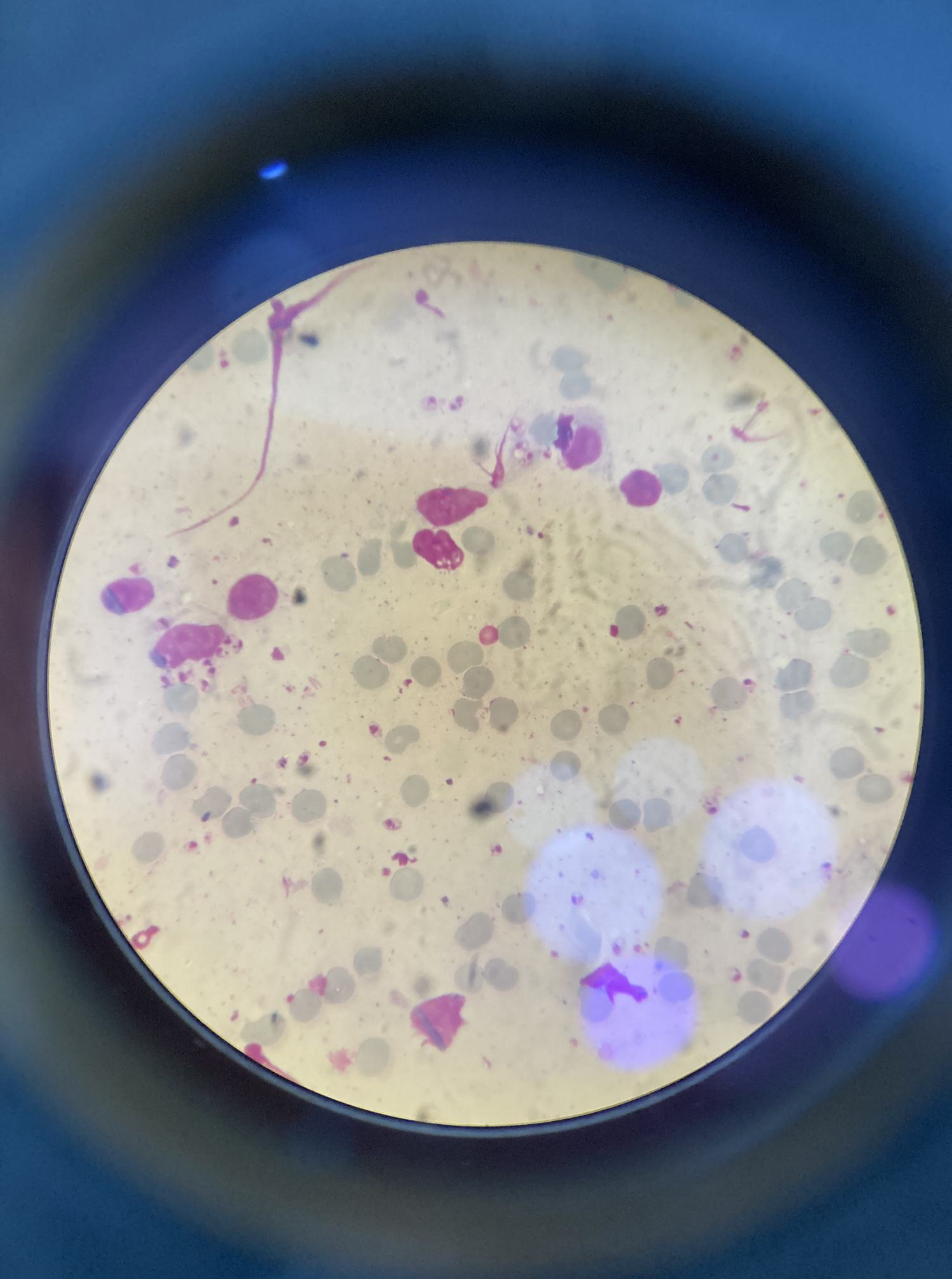 mama Object Detection Dataset and Pre-Trained Model by leish