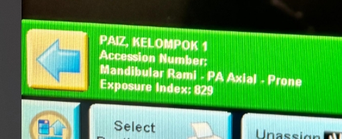 Exposure Index Object Detection Dataset by ocr