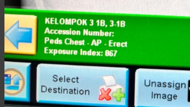 OCR Number Mark Object Detection Dataset by ocr