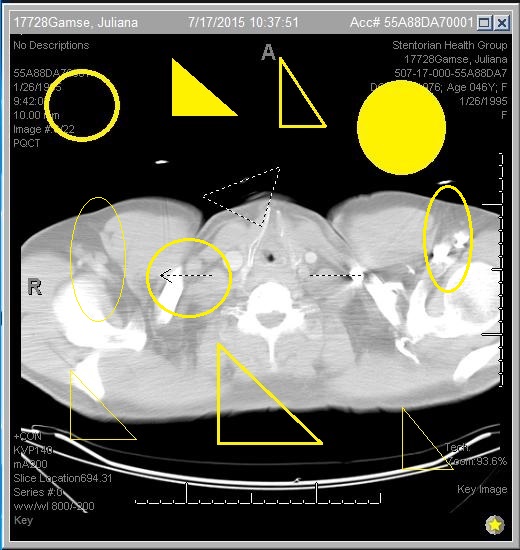 Objdetc Object Detection Model By Objectdetection 8715