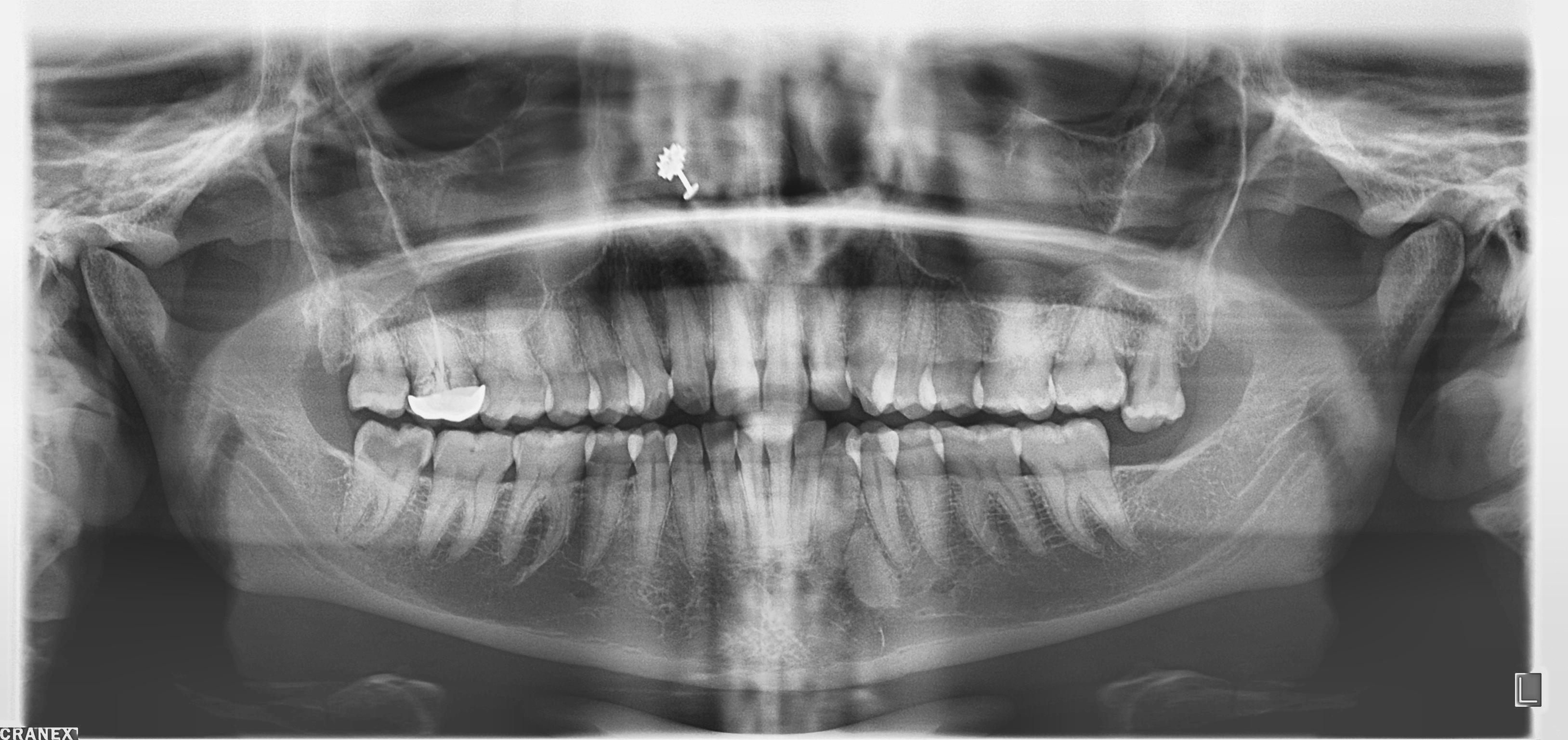 keypoint based R CNN Object Detection Dataset by ML