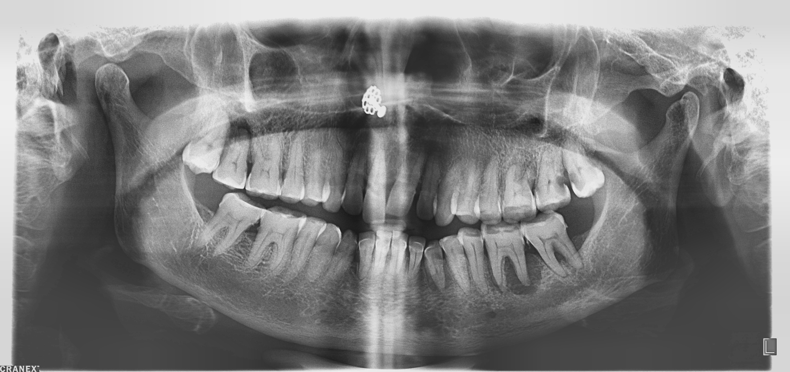 root_seg Instance Segmentation Dataset by ML