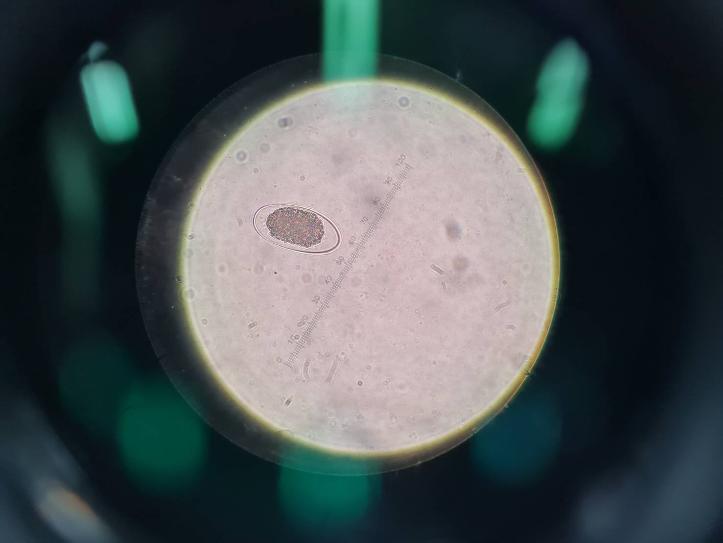 yolov8 parasite Object Detection Dataset by Test