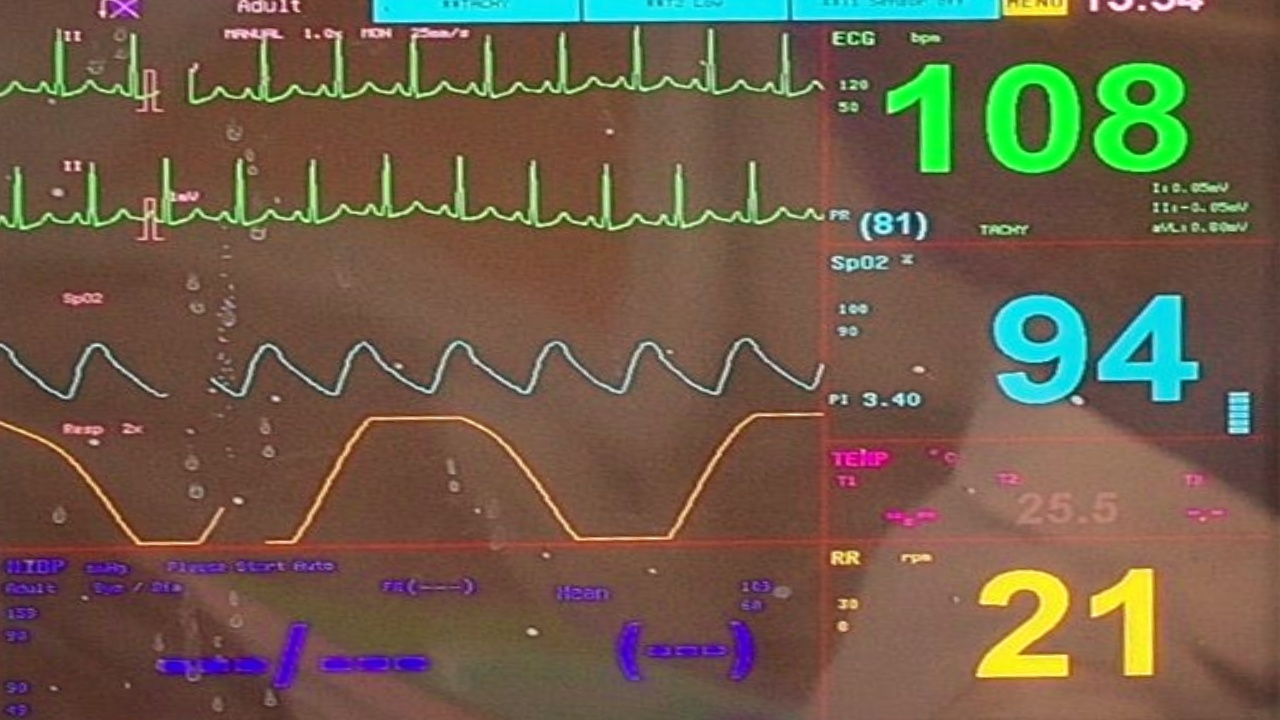BPL-Ultima-PrimeD-A Object Detection Dataset by monitor detection