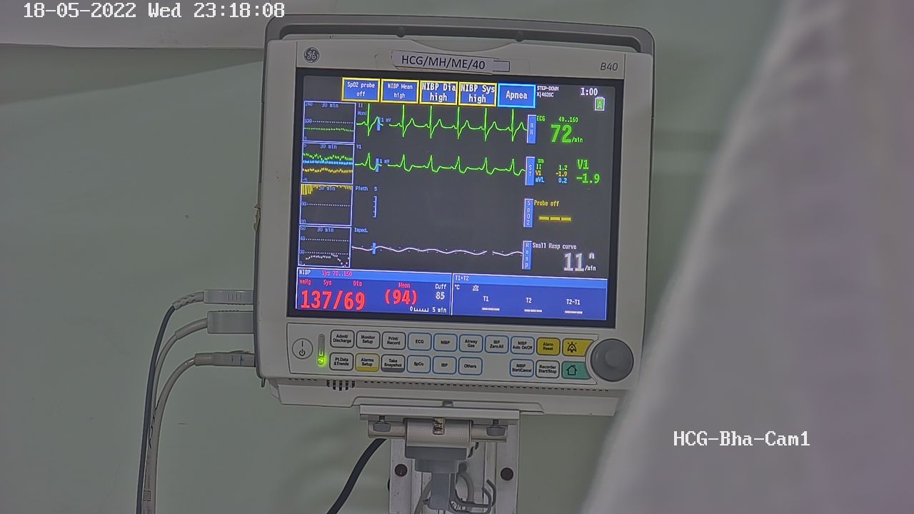 Monitor Screen detection Semantic Segmentation Model by monitor detection