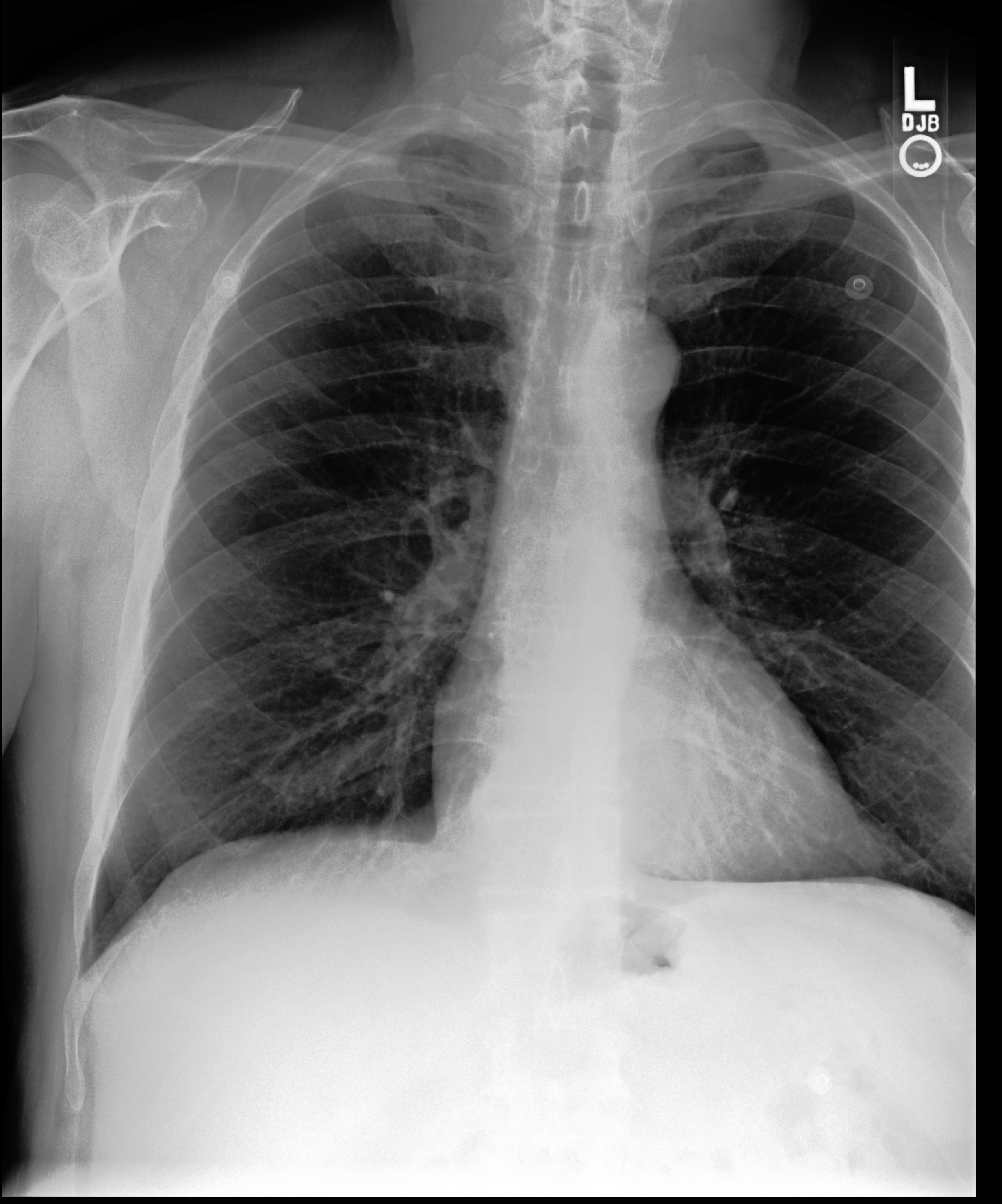 Mimic Eye Dataset Main Object Detection Dataset By Samml