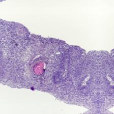 Histopath Instance Segmentation Dataset and Pre-Trained Model by histropath