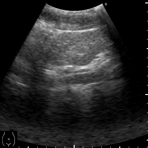 Ivc Instance Segmentation Dataset by school