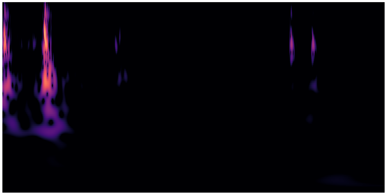 Asd Keyboard No White Object Detection Dataset By Unicamp