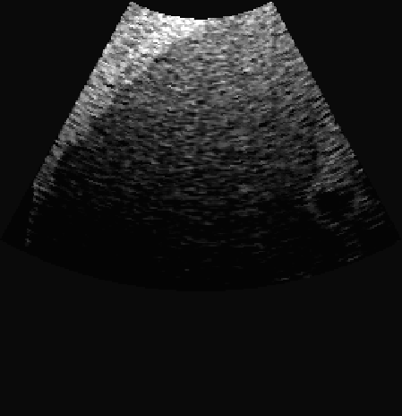fi90 Instance Segmentation Model by liverfib