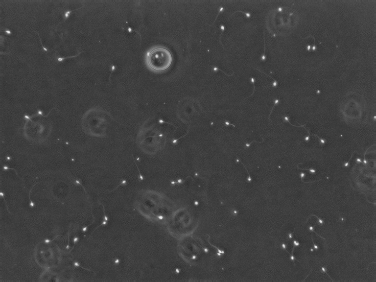 Sperm Morfoloji Etiket grup 1 Object Detection Dataset and Pre-Trained Model by ssy0000069