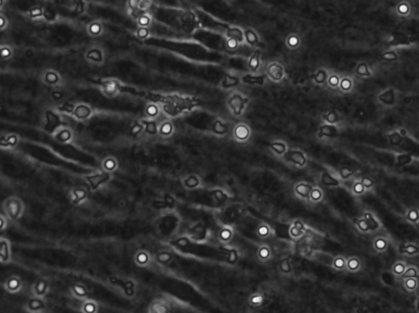 Static Adhesion Object Detection Dataset By Mustafa Sevim