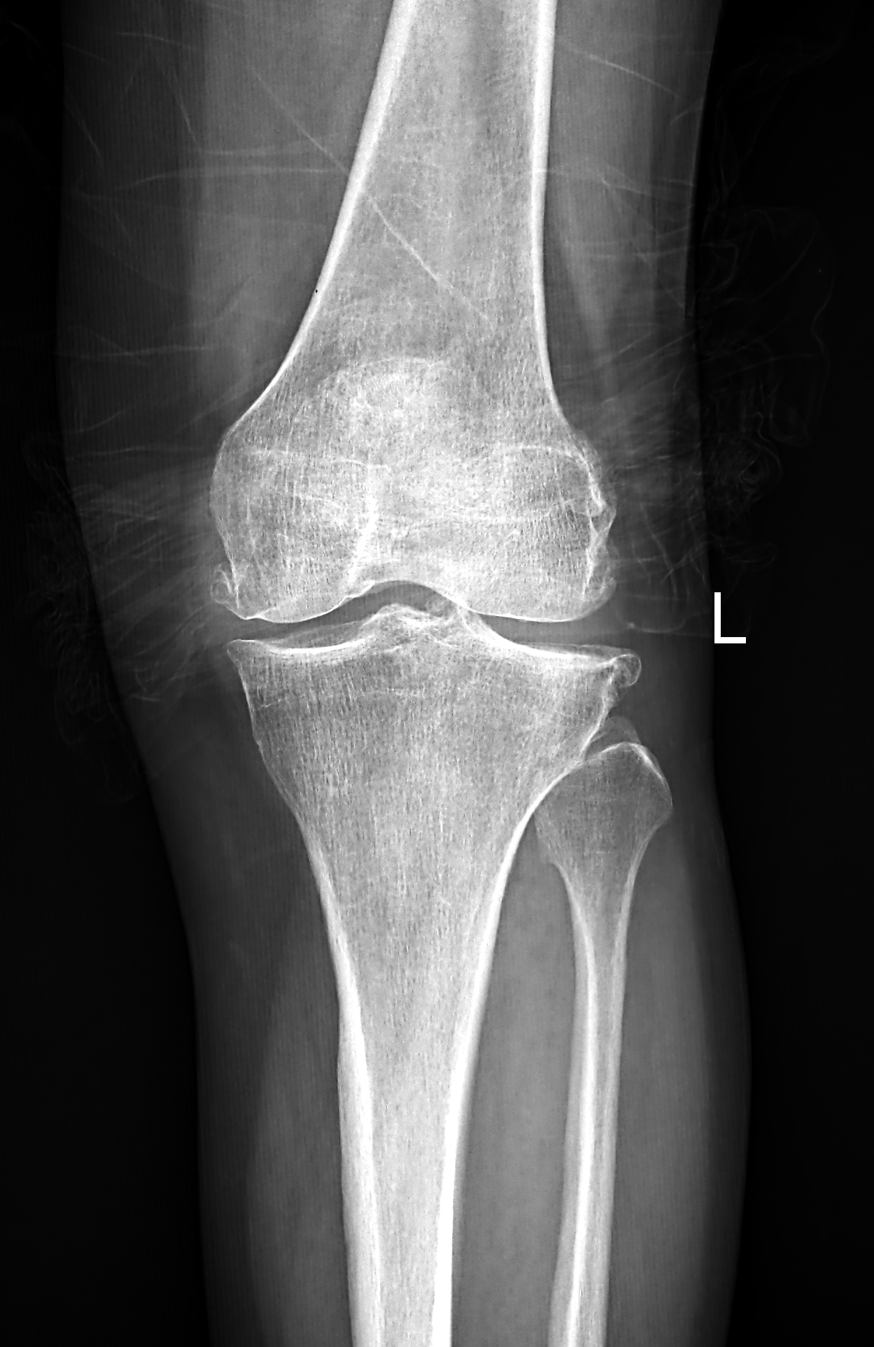 Bien_dataset Instance Segmentation Model by MEDICAL PROJECT