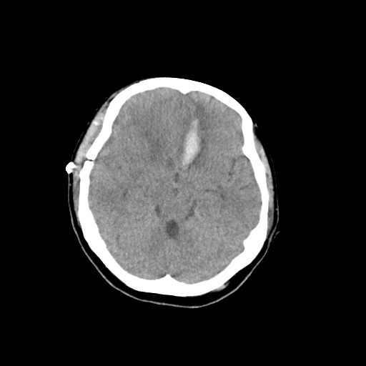 Brain Classification Dataset by Apache