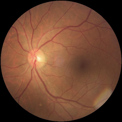 Eye Disease Classification Model by EnviroShit