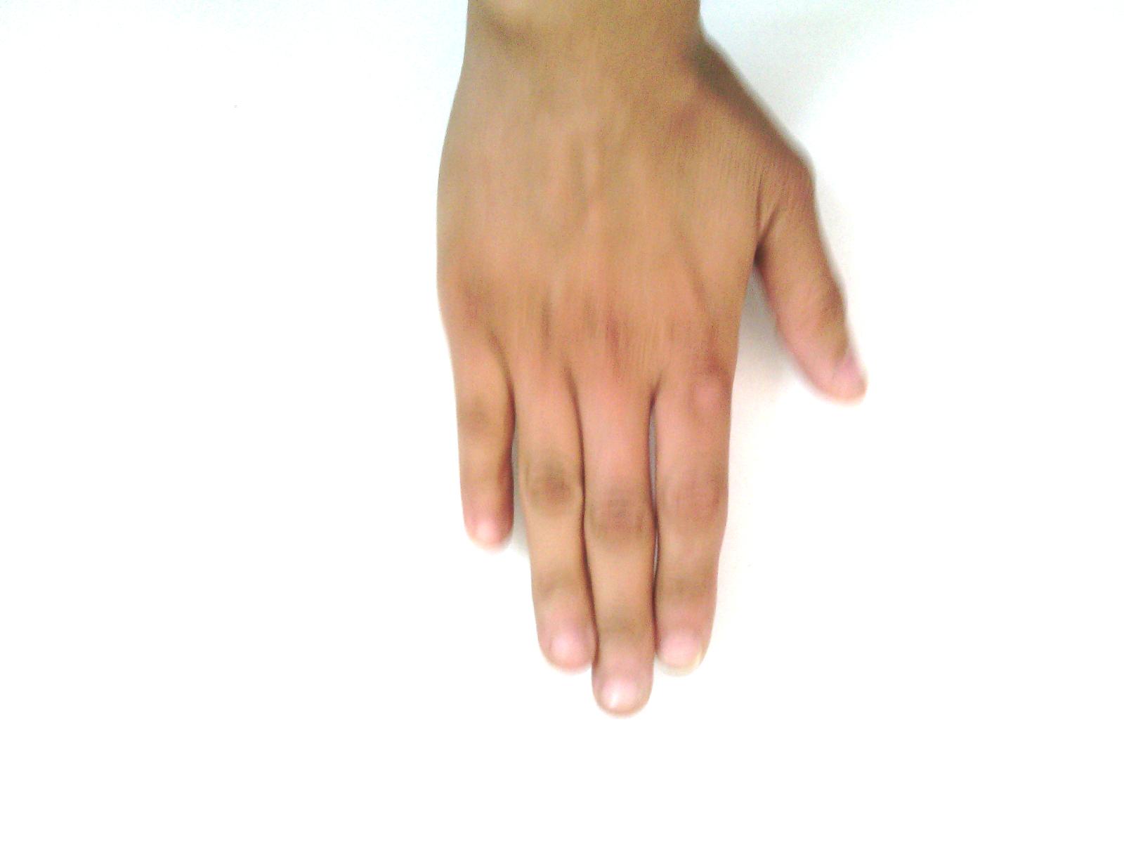 Palm Dataset - Roboflow Universe Palm Dataset - Roboflow Universe