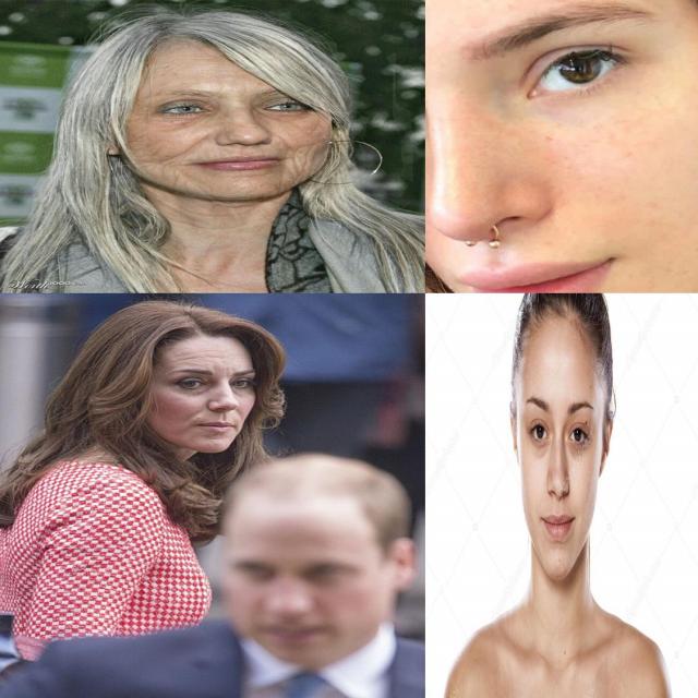 Skin Problem Image Segmentation Semantic Segmentation Dataset By Hetvi Eww