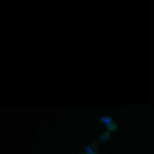 Canner Cell Segmentation Instance Segmentation Dataset and Pre-Trained Model by Yuki