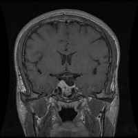 Labeled MRI Brain Tumor Dataset Object Detection Model by Ali Rostami