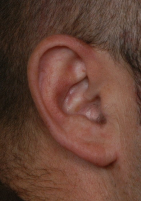 Ear Detection Object Detection Dataset by Ears Detection