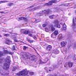 PanNuke-GAN-Augmented Instance Segmentation Model by Ahmed WS