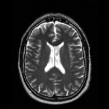 brain Object Detection Dataset by loc