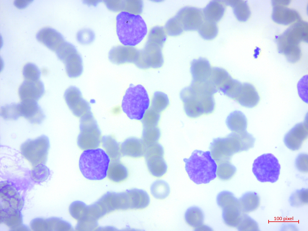 Cancer Blood Cells Object Detection Dataset by Data Set