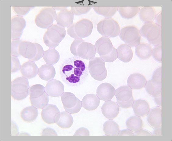Blutausstrich Classification Model (v2, 2022-07-12 3:57pm) by Blutausstrich