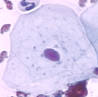 smear Classification Dataset by Technomedicare