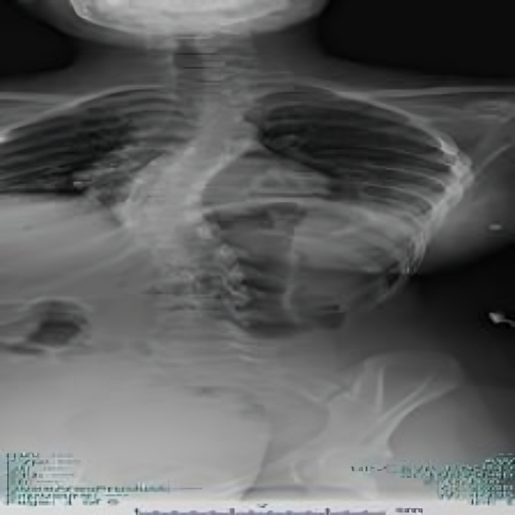 Object Detection Object Detection Dataset by university