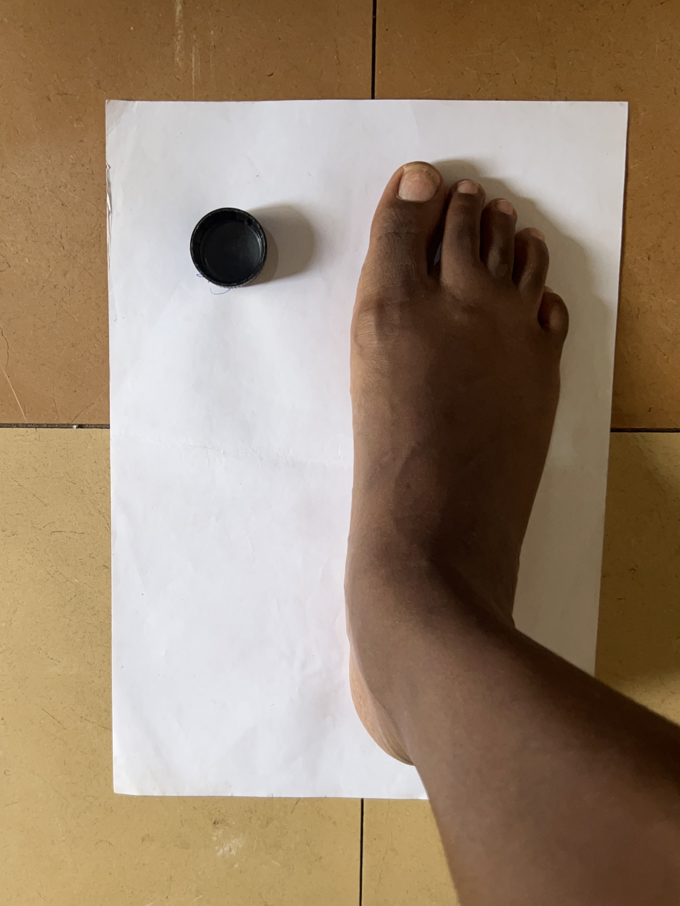 Foot_Top_View Object Detection Model by Bos Kona