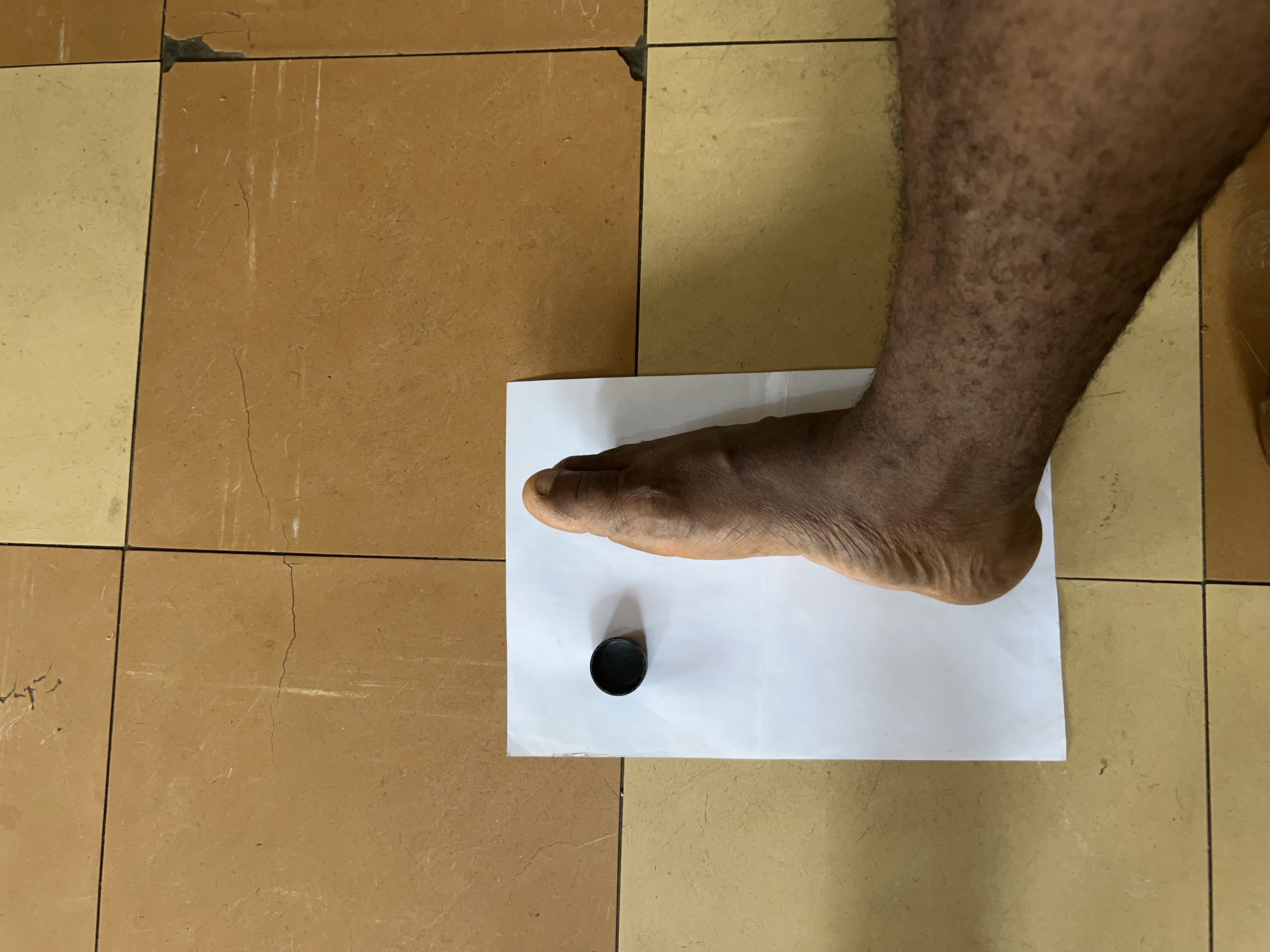Foot_side_view Object Detection Model by Bos Kona