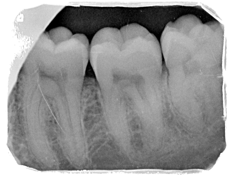 Conecut classification Classification Dataset by Treatment Planning Project