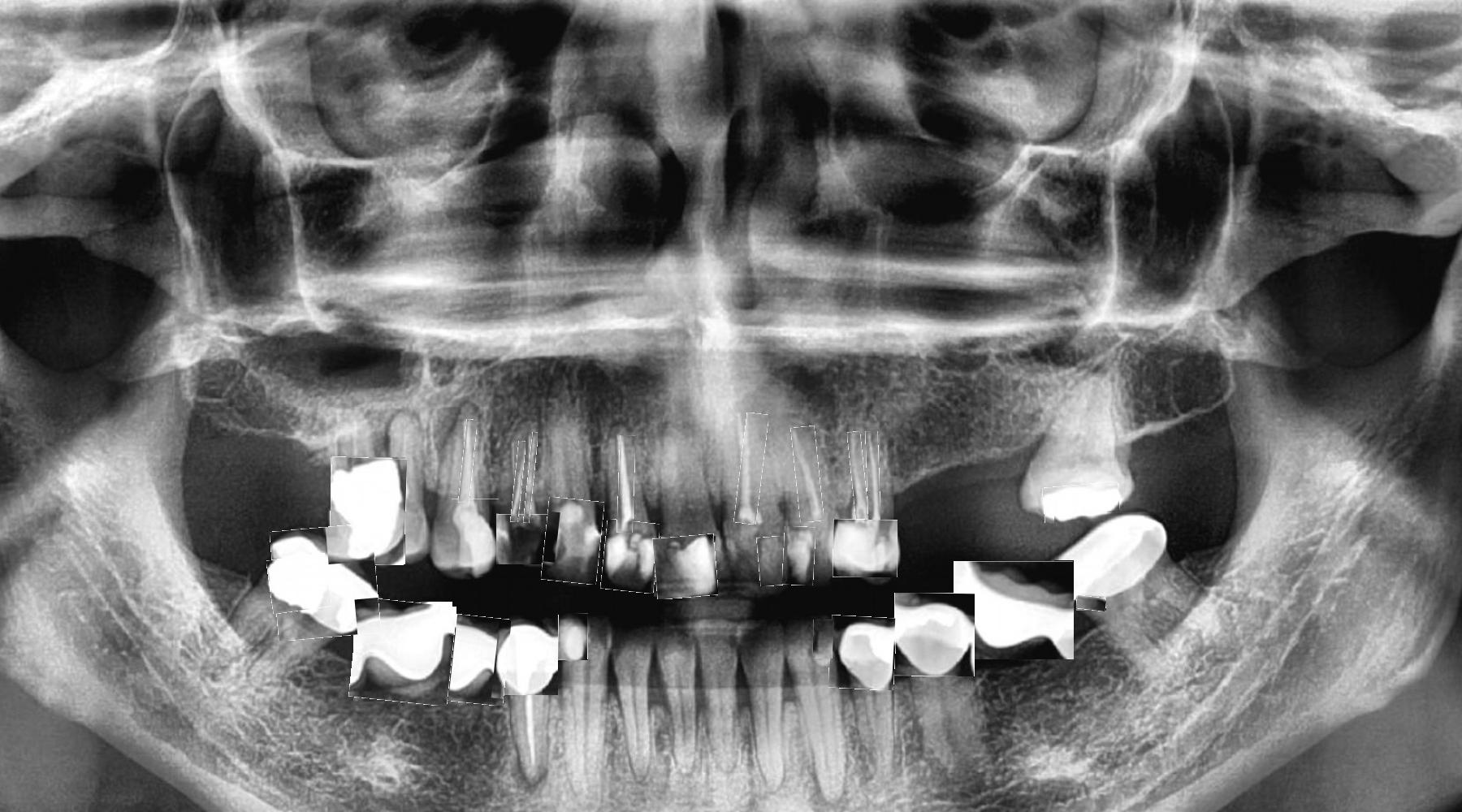 Teeth Segmentation Instance Segmentation Dataset by Internship
