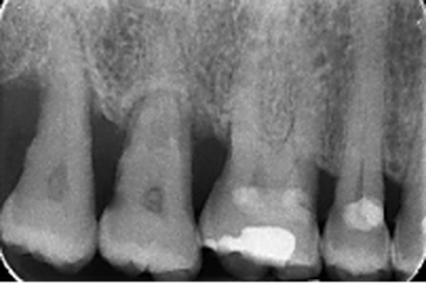 Root apex Object Detection Dataset by University of Alberta