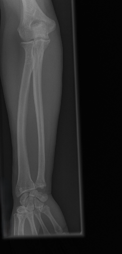 Extra (extra-8k9a5) - Roboflow Universe