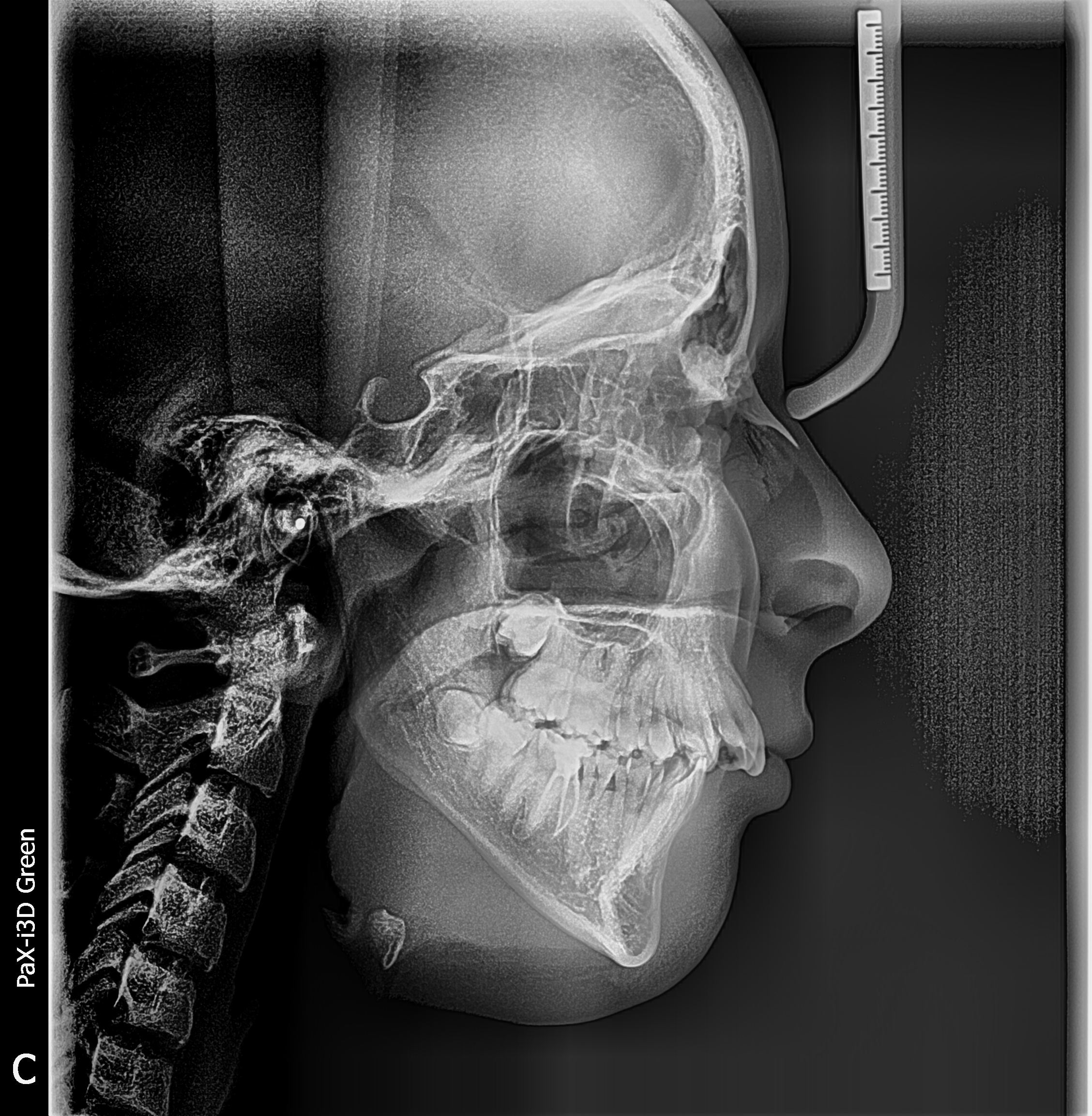 Cvm Levels Dataset Object Detection Dataset And Pre Trained Model By May