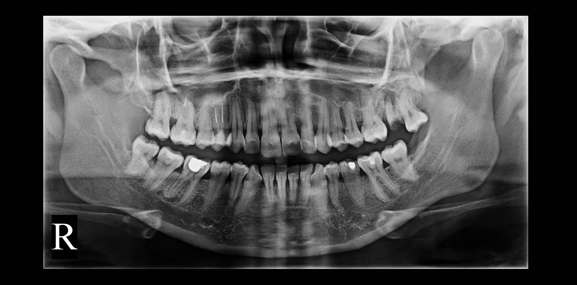 Dental Practice Object Detection Dataset And Pre Trained Model By