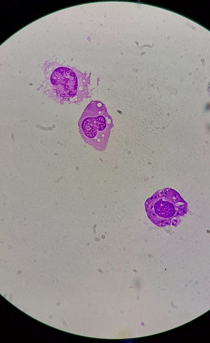 BIND Project - Roboflow Universe