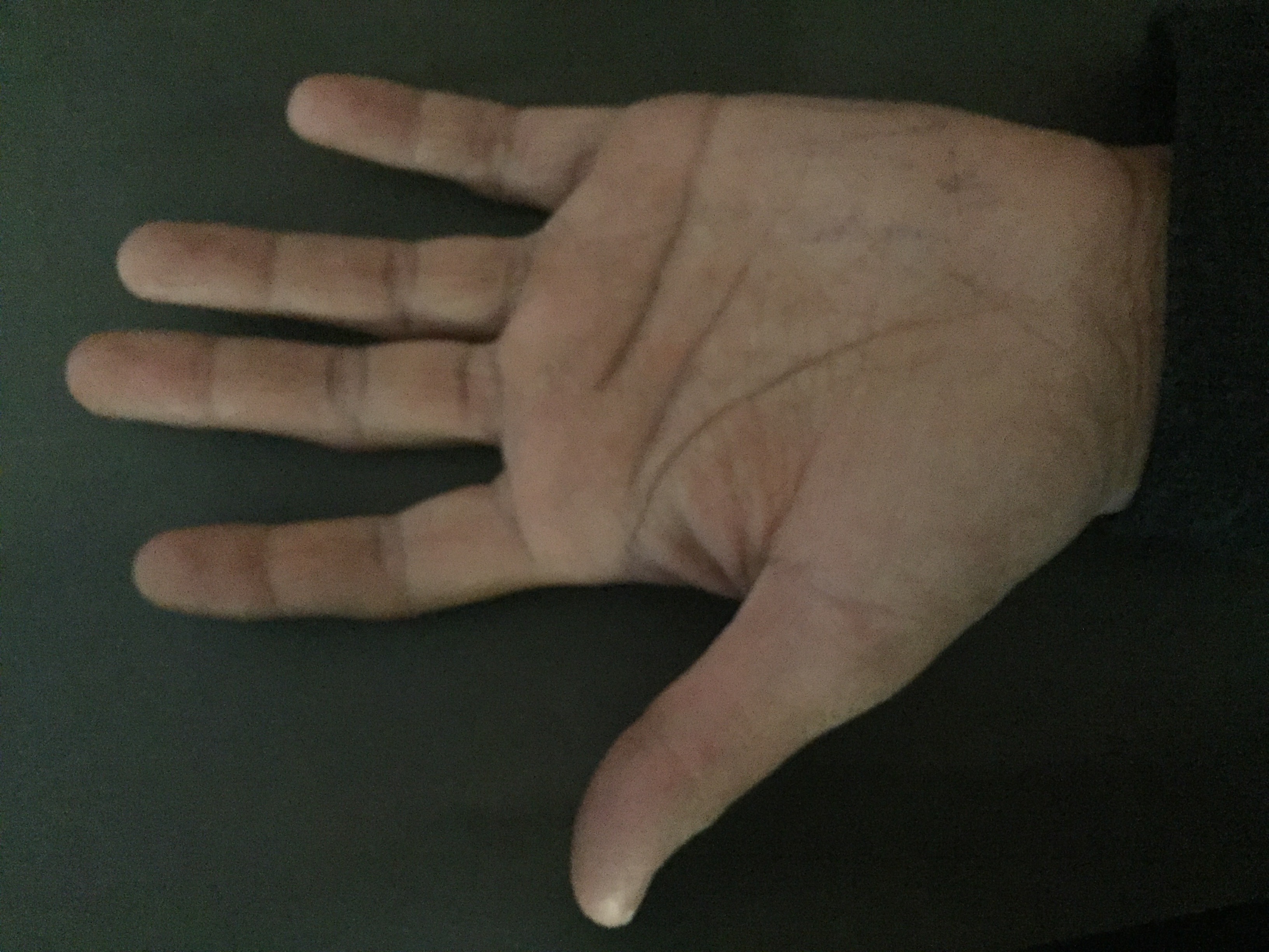 hand main line detection Object Detection Dataset and Pre-Trained Model ...