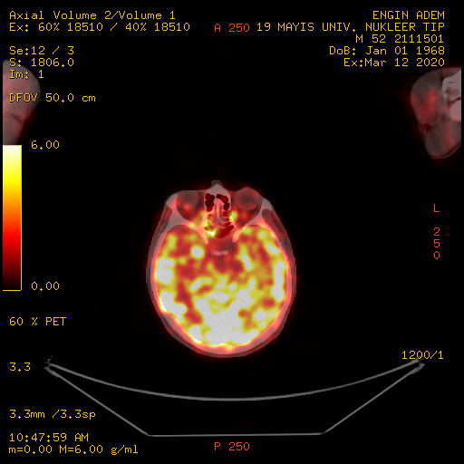 Engin_Adem Object Detection Dataset by Akcigerkanseri2