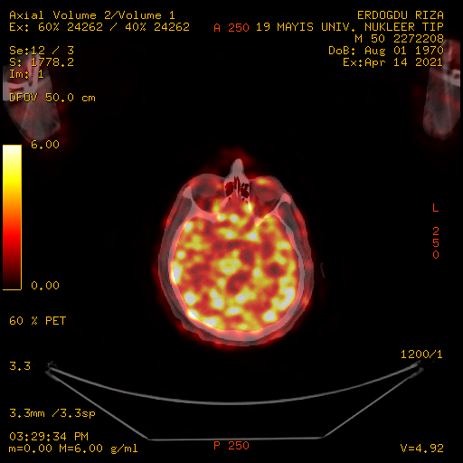 Erdoğdu_Rıza Object Detection Dataset by Akcigerkanseri2