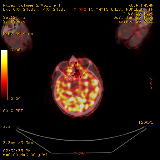 Koca_Hasan Object Detection Dataset by Akcigerkanseri2